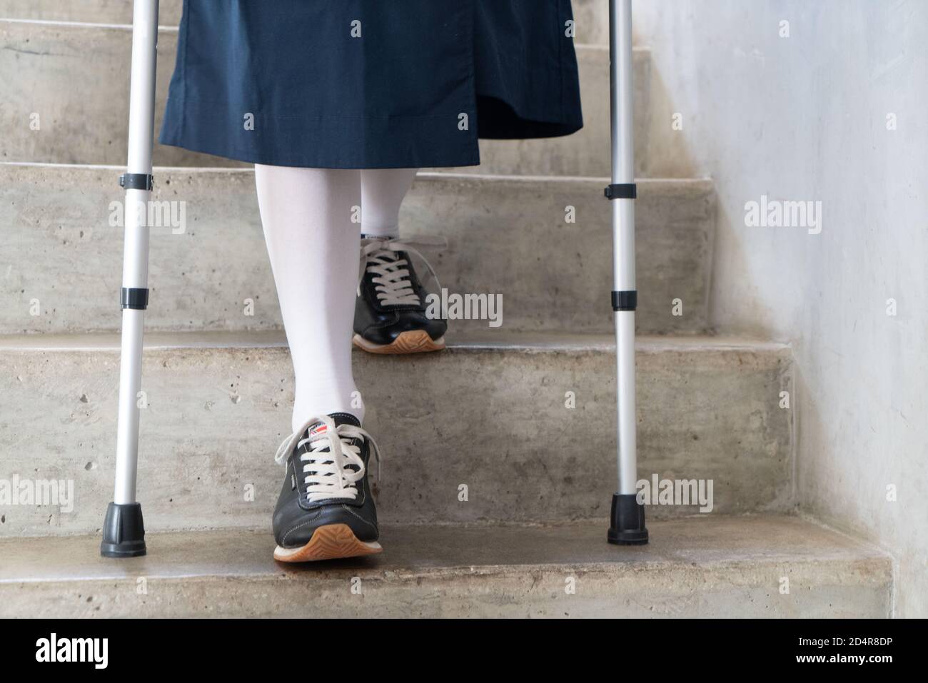 Femoral neck fracture hi-res stock photography and images - Alamy