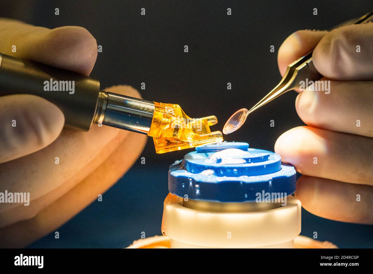 Lamellar cornea graft, Preparation of the graft,Trepanation and graft ...