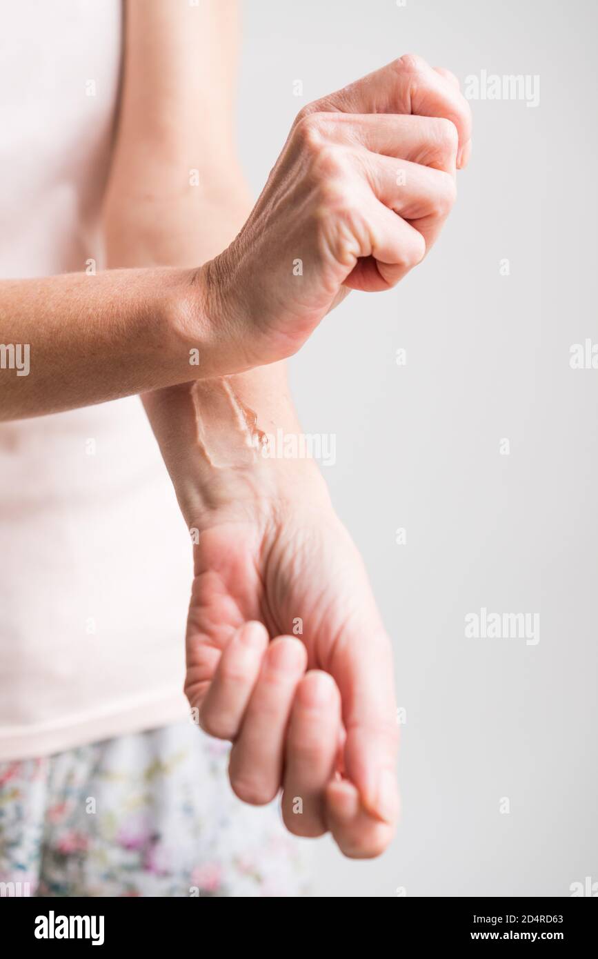 Woman applying estrogen gel on hi-res stock photography and images - Alamy