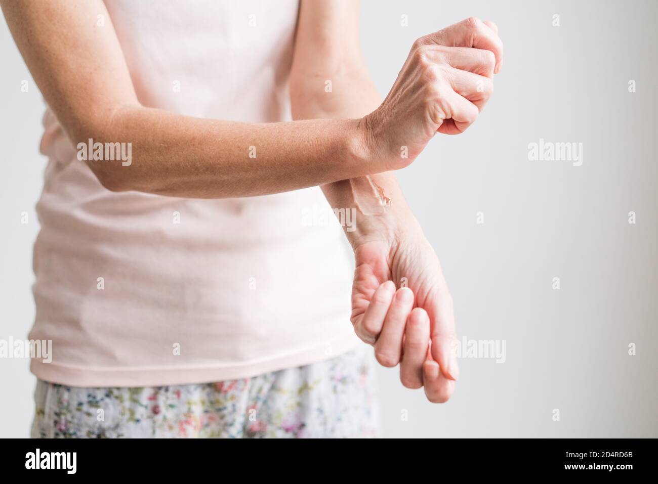 Woman applying an estrogen gel on her hands for a Hormone Replacement ...
