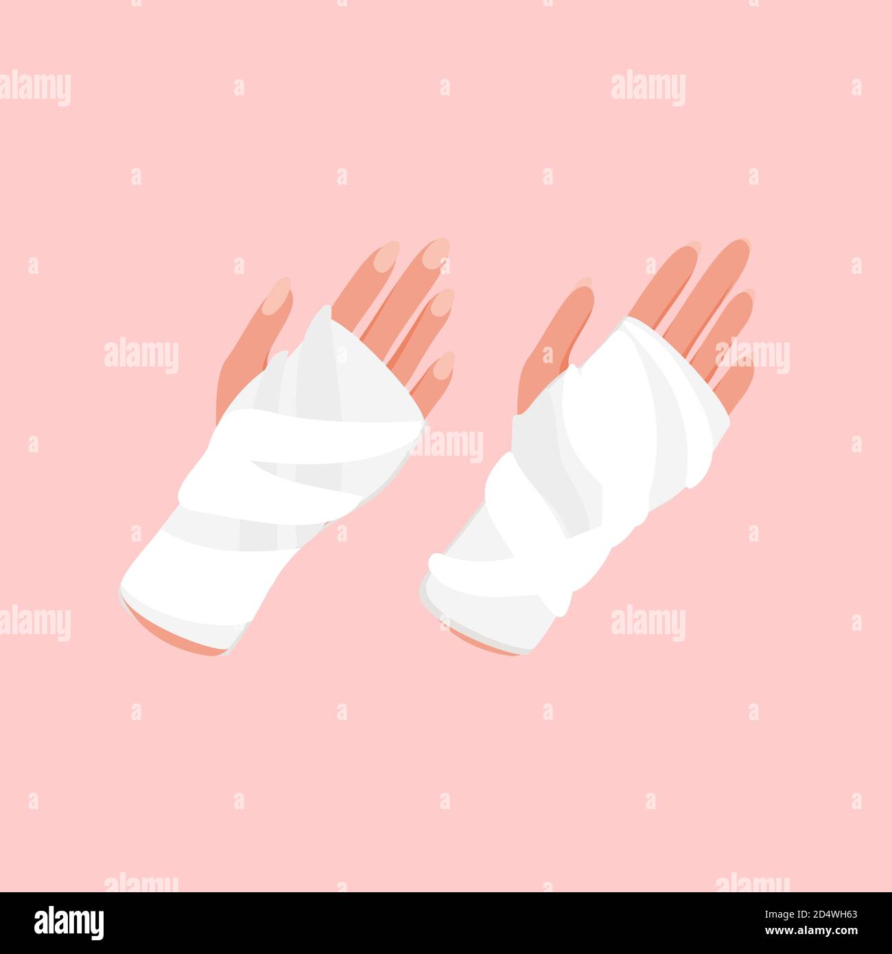 Broken arm, bone fracture, orthopedic plaster cast icon on pink ...