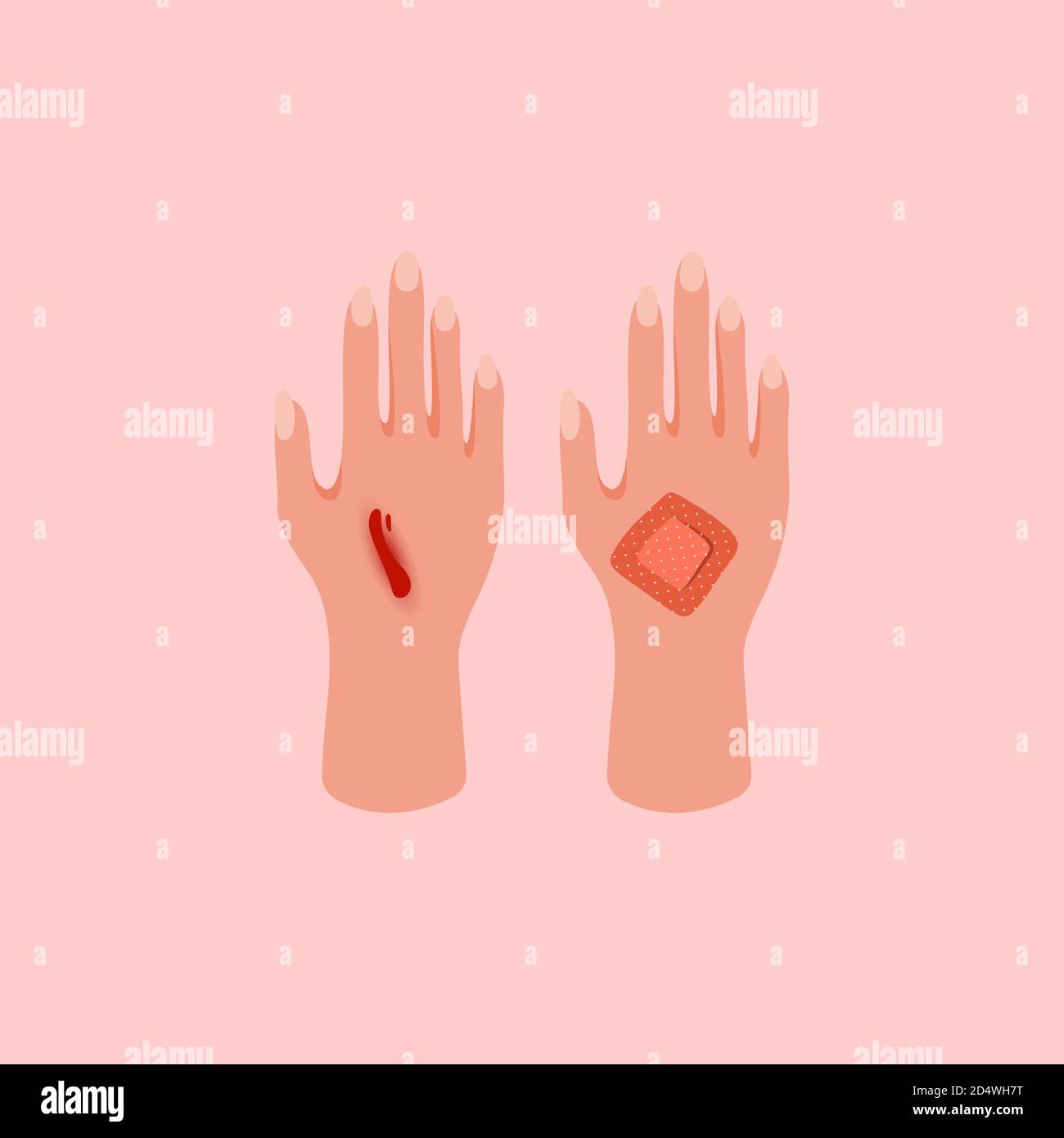 Broken, cut, injured hand. First aid for bruises, trauma icon on pink ...