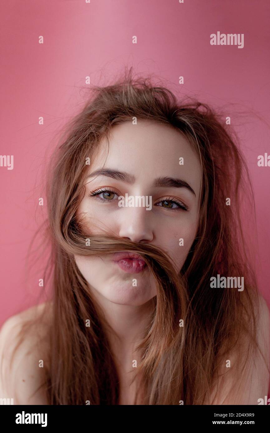 Problem scalp, greasy dirty hair girl, haircare concept Stock Photo - Alamy
