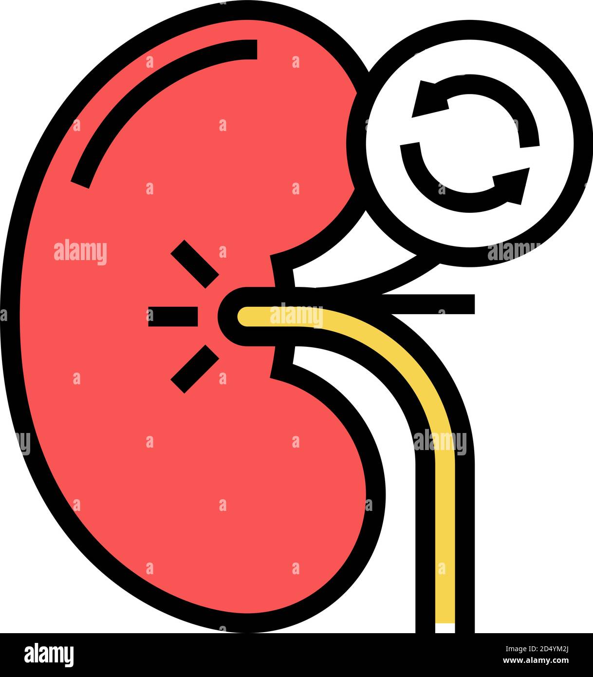 kidney transplant color icon vector illustration Stock Vector Image ...