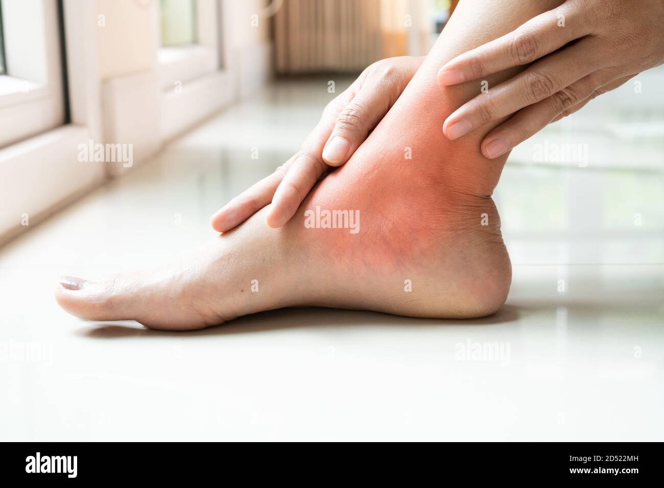 women leg ankle injury/painful, women touch the pain ankle leg Stock ...