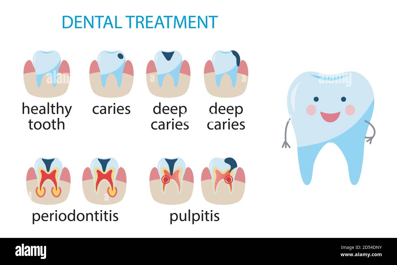 Dental treatment poster. Icon Diseases of teeth. caries, pulpitis ...