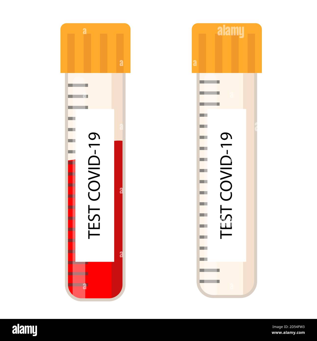 Determination of the coronavirus in the patient's blood. Laboratory ...
