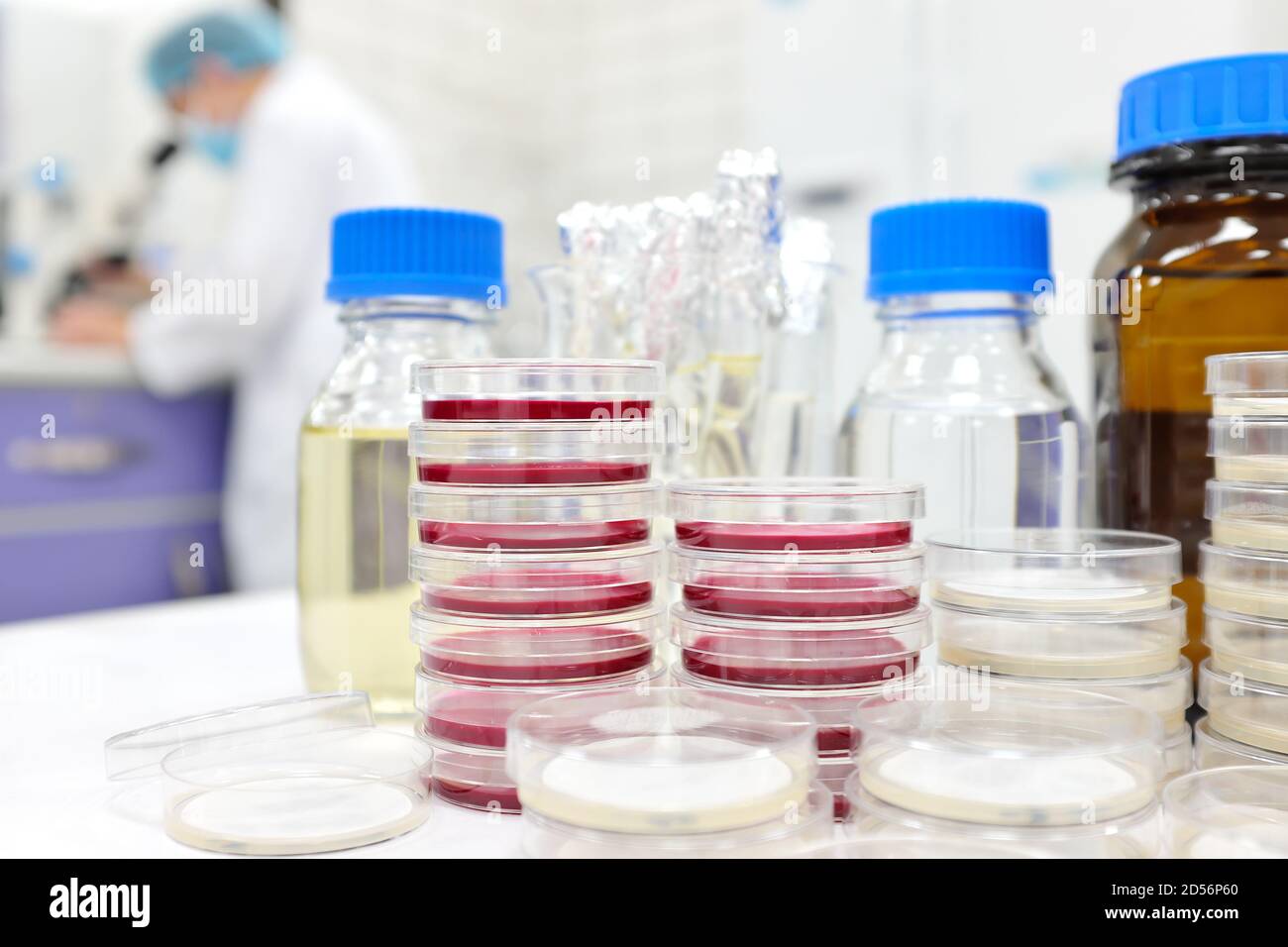 Selective focus of stack of petri dish with agar and a scientist ...