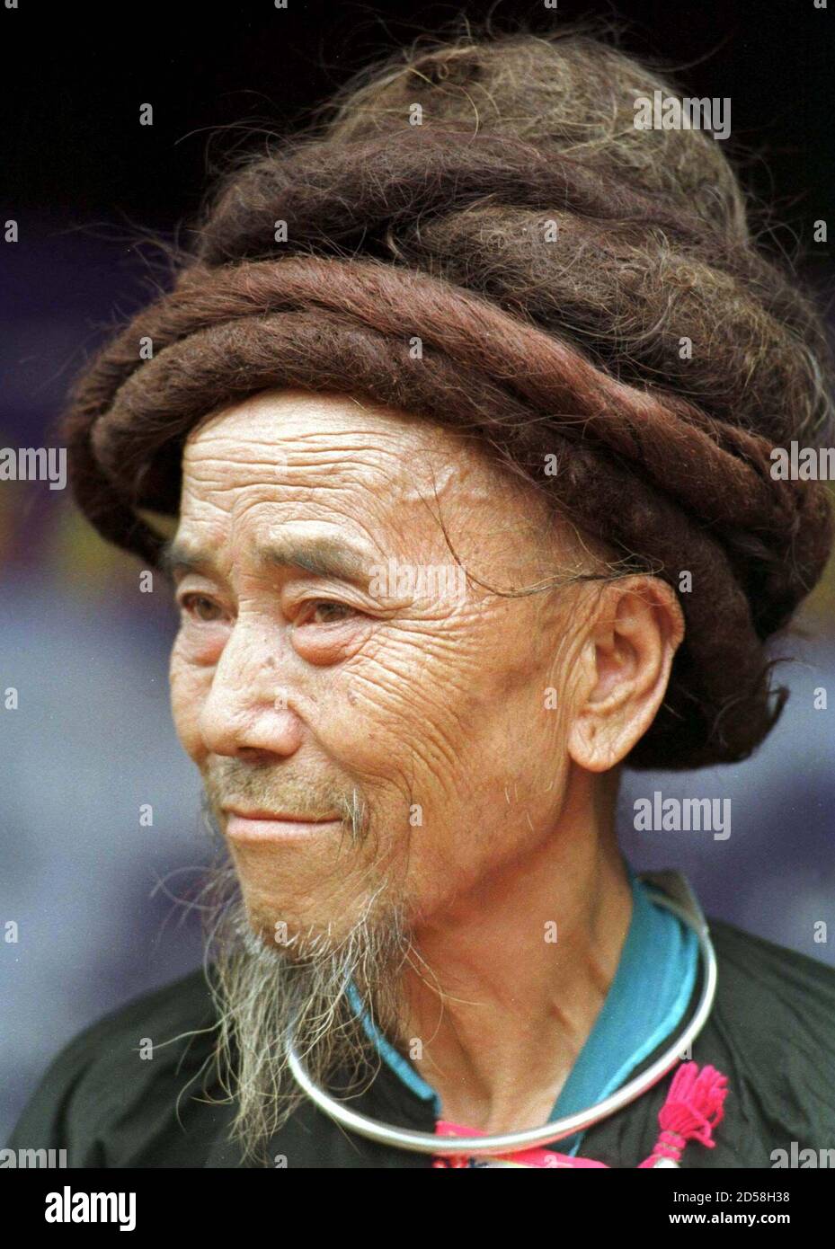 Worlds Longest Arm Hair