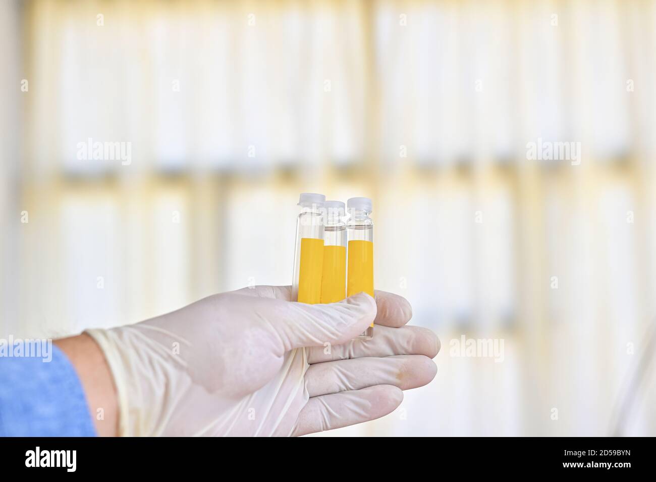 Medical sample hi-res stock photography and images - Alamy
