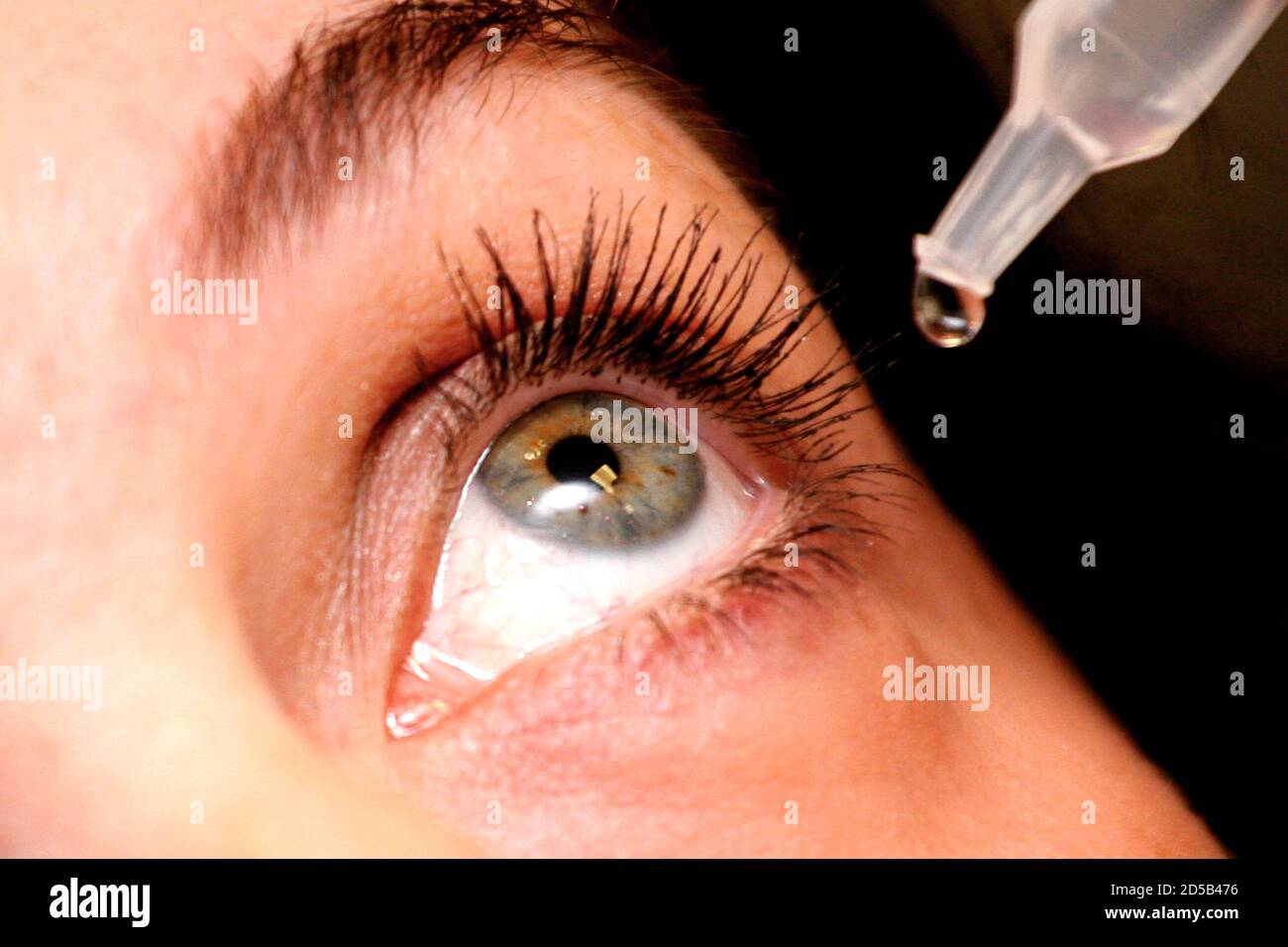 close up of drops in the eye by an optician, during an eye examination ...