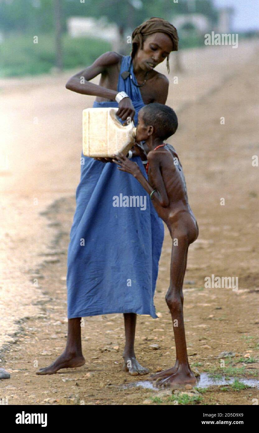 Somalia child starving hi-res stock photography and images - Alamy