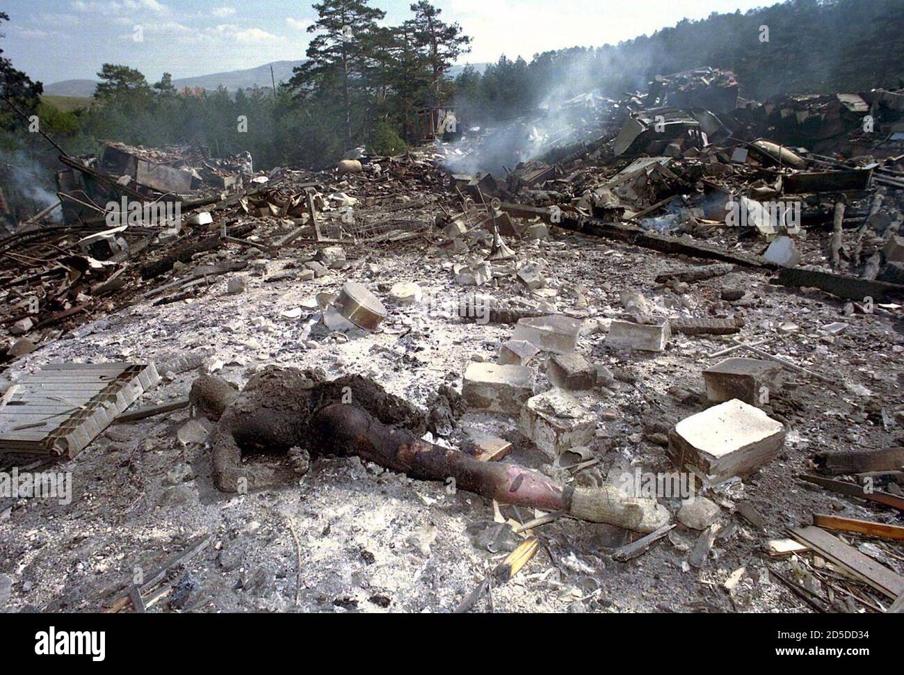 Burned body hi-res stock photography and images - Alamy