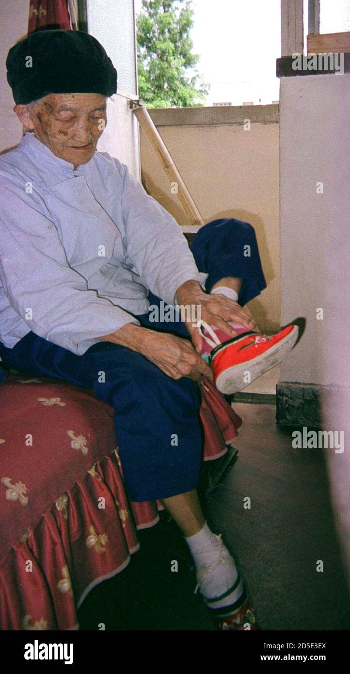 Deformed baby hi-res stock photography and images - Alamy