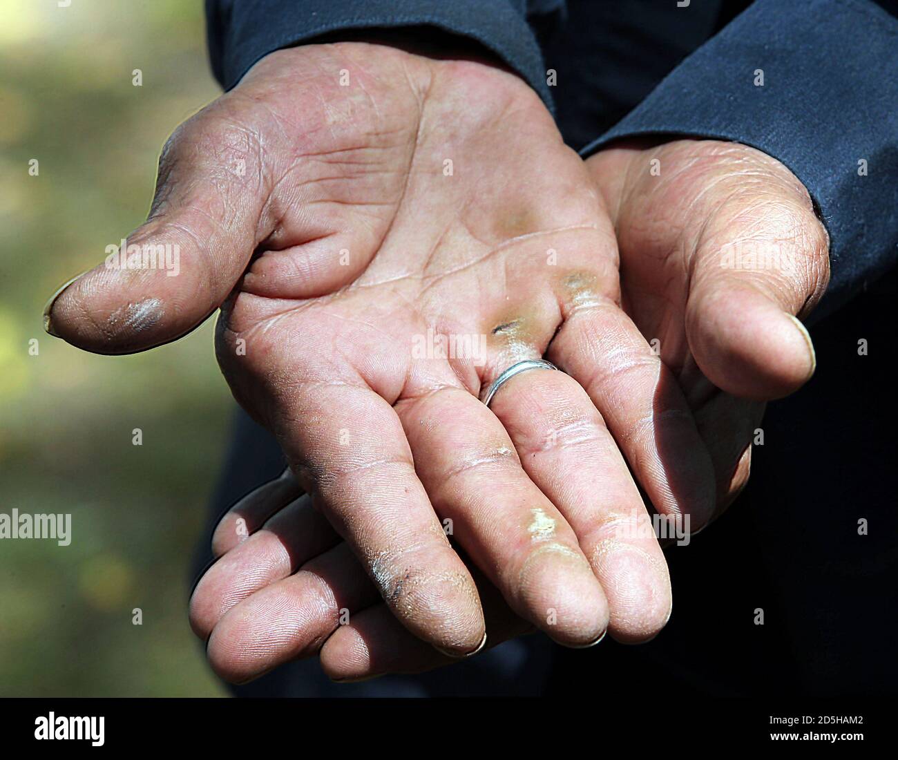 Calloused hands hi-res stock photography and images - Alamy