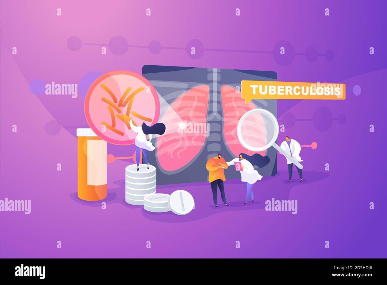 Tuberculosis concept vector illustration Stock Vector Image & Art - Alamy