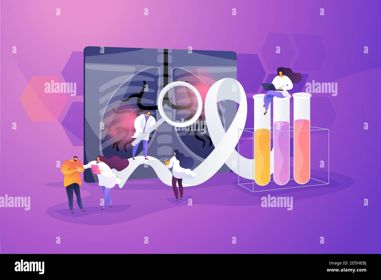 Larynx cancer illustration Stock Vector Images - Alamy