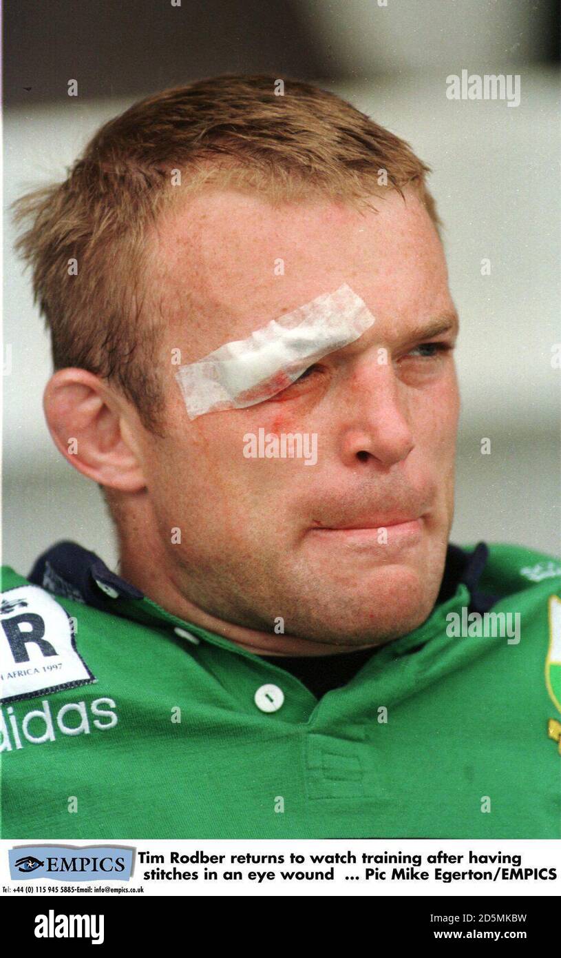 Tim Rodber returns to watch training after having stitches ib an eye ...