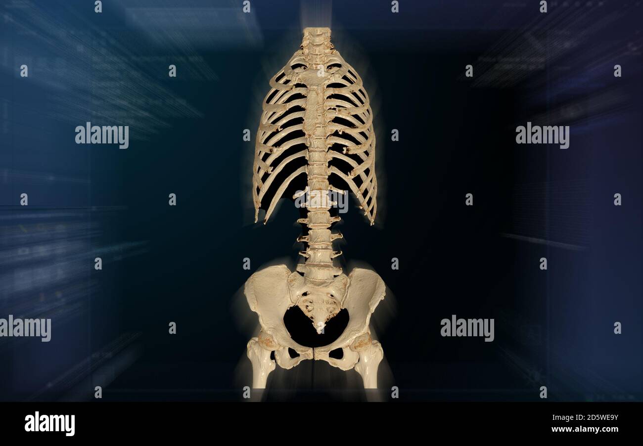CT SCAN of Whole spine 3d rendering isolated on blurred monitor ...