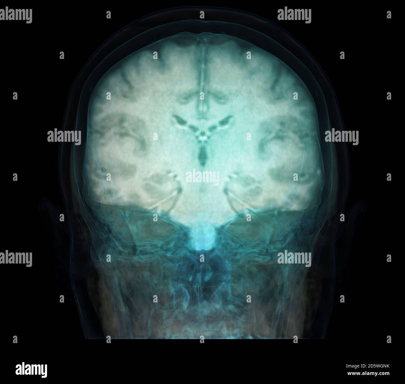 Mri scan sagittal brain color hi-res stock photography and images - Alamy
