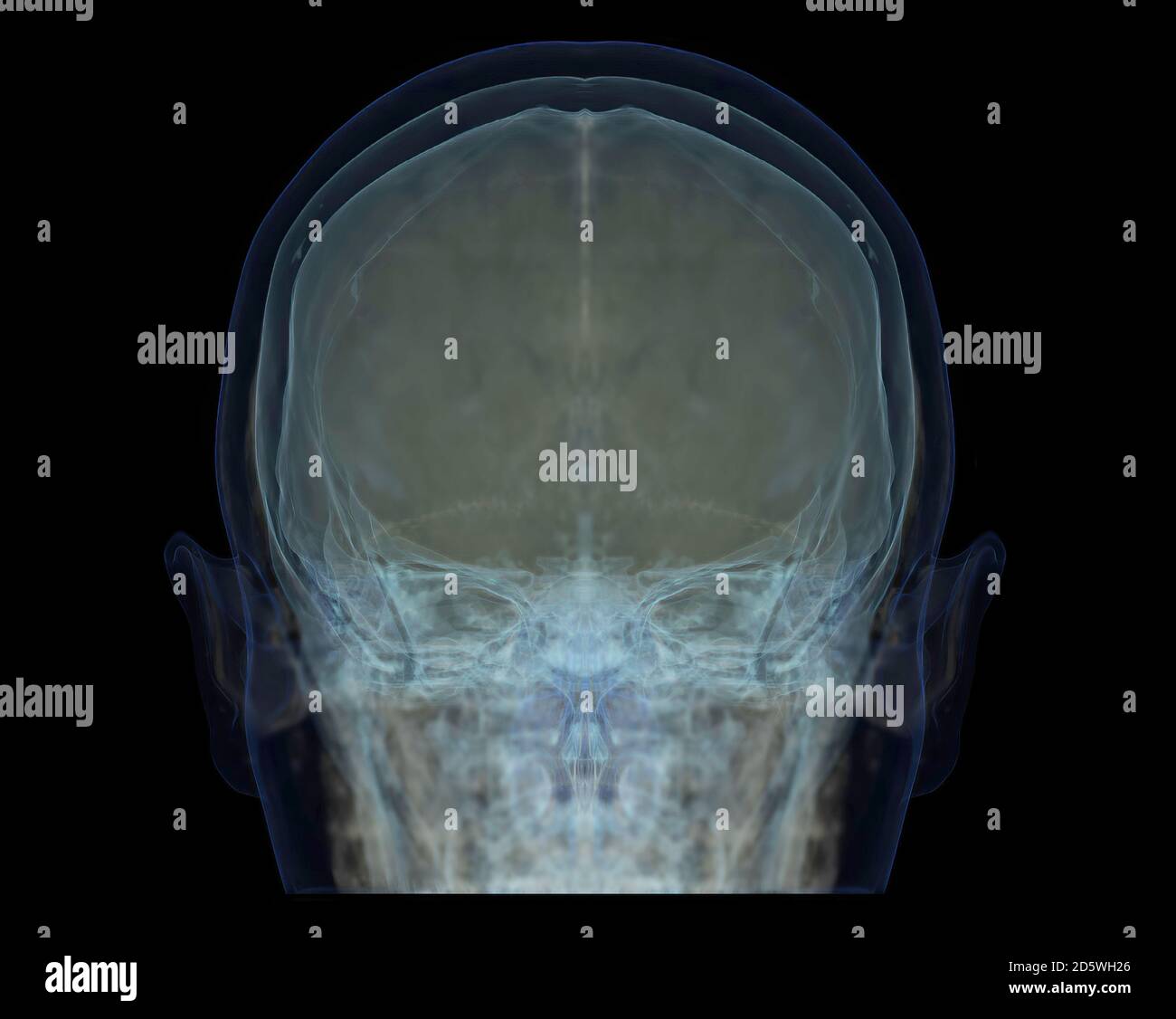 Mri scan sagittal brain color hi-res stock photography and images - Alamy
