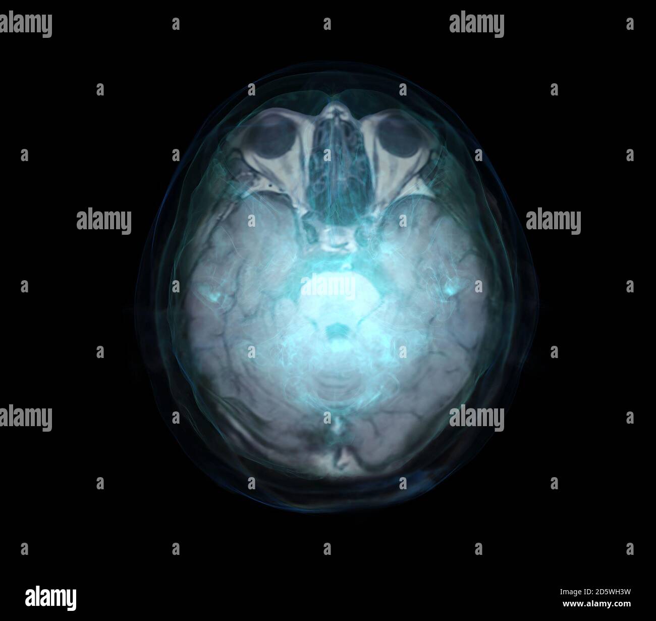 Mri scan sagittal brain color hi-res stock photography and images - Alamy