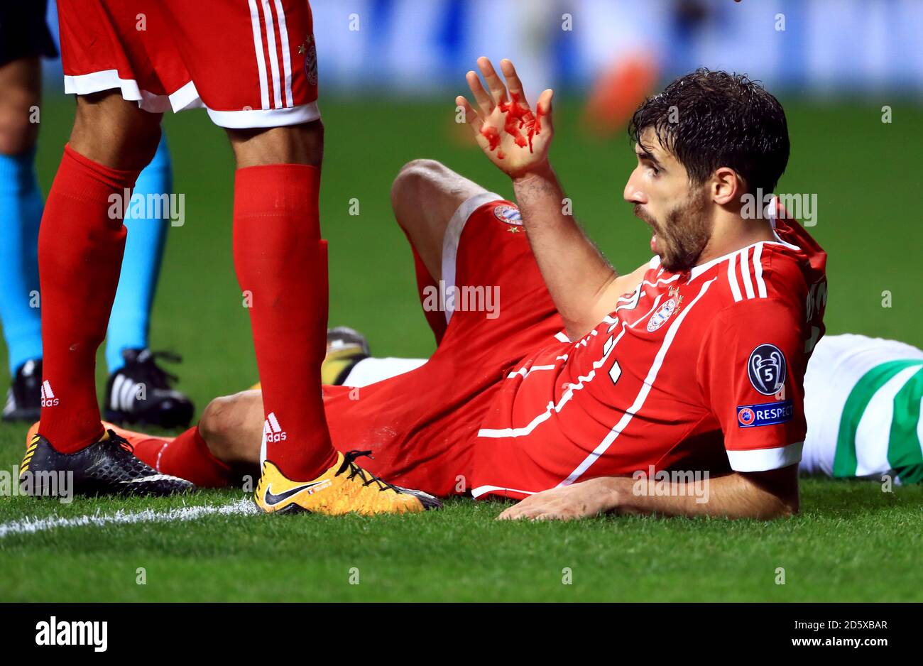 Soccer football blood bleeding hi-res stock photography and images - Alamy