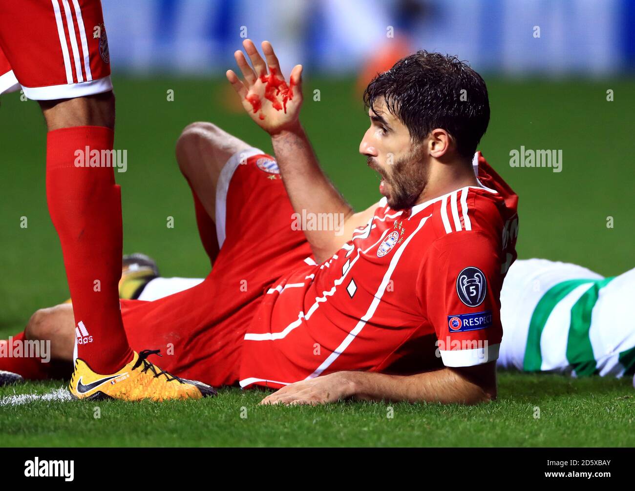 Soccer football blood bleeding hi-res stock photography and images - Alamy