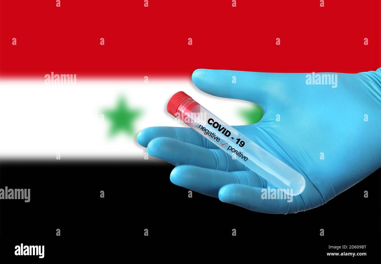 Testing for presence of coronavirus. Tube containing a swab sample that ...