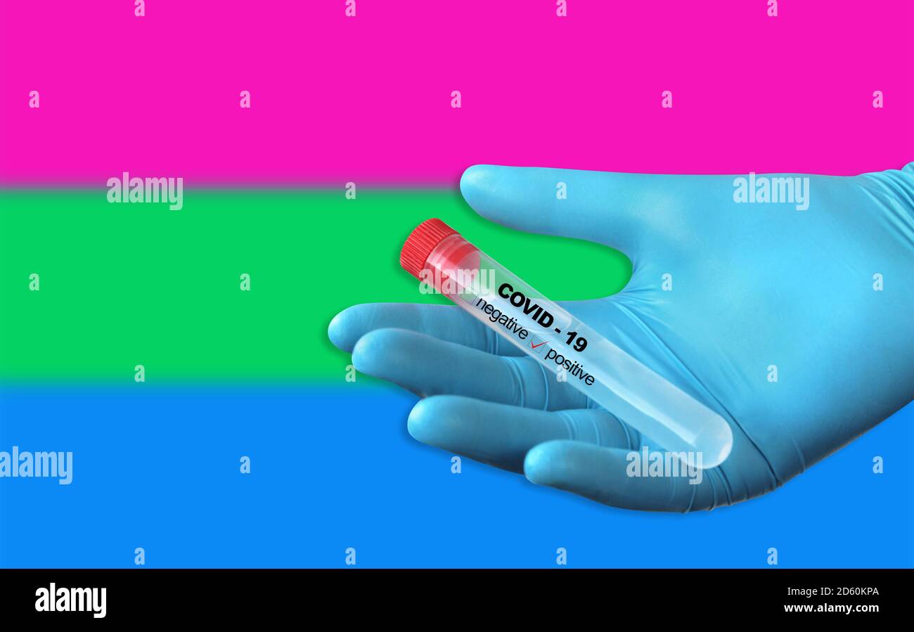 Testing for presence of coronavirus. Tube containing a swab sample that ...