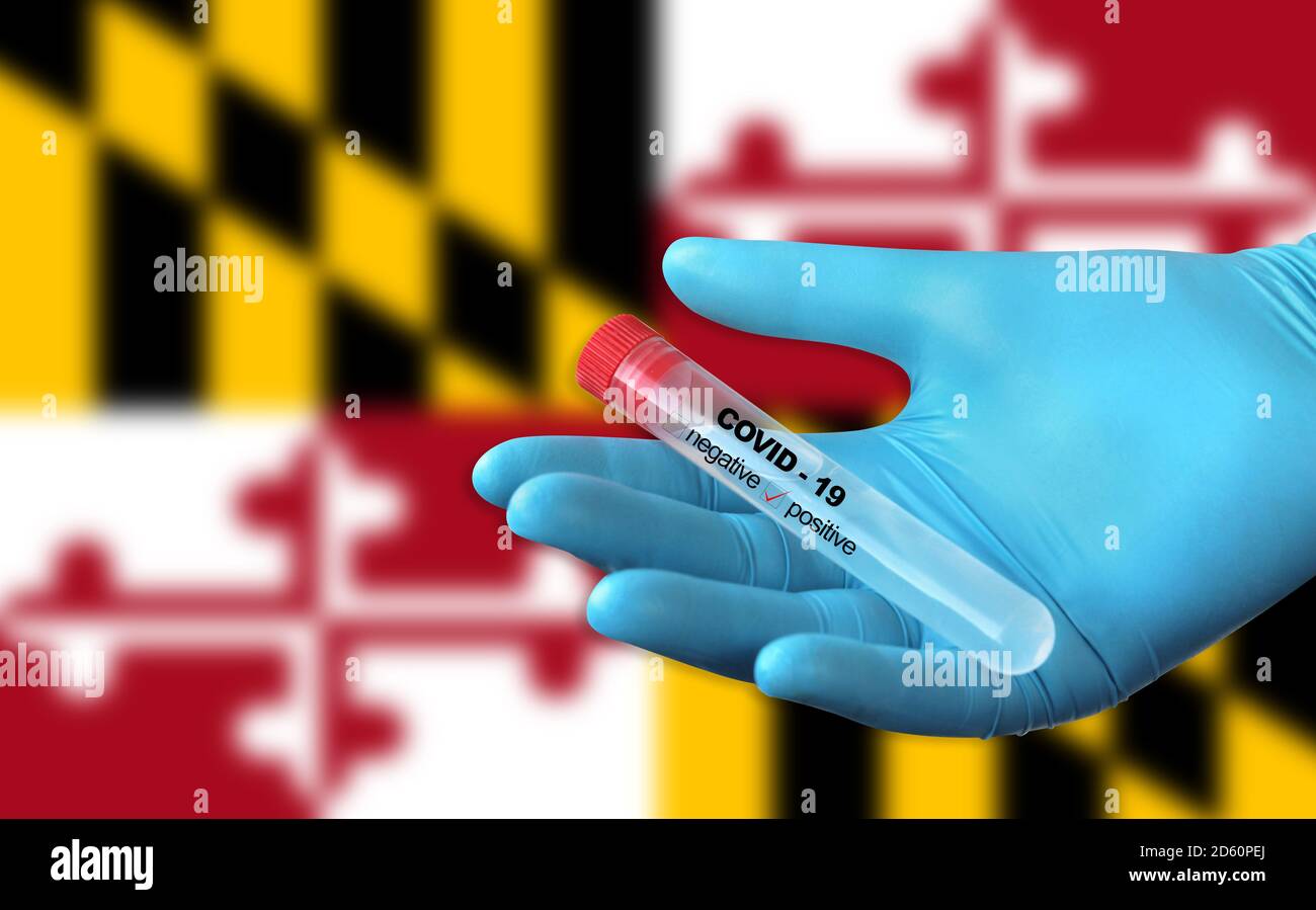 Testing for presence of coronavirus. Tube containing a swab sample that ...