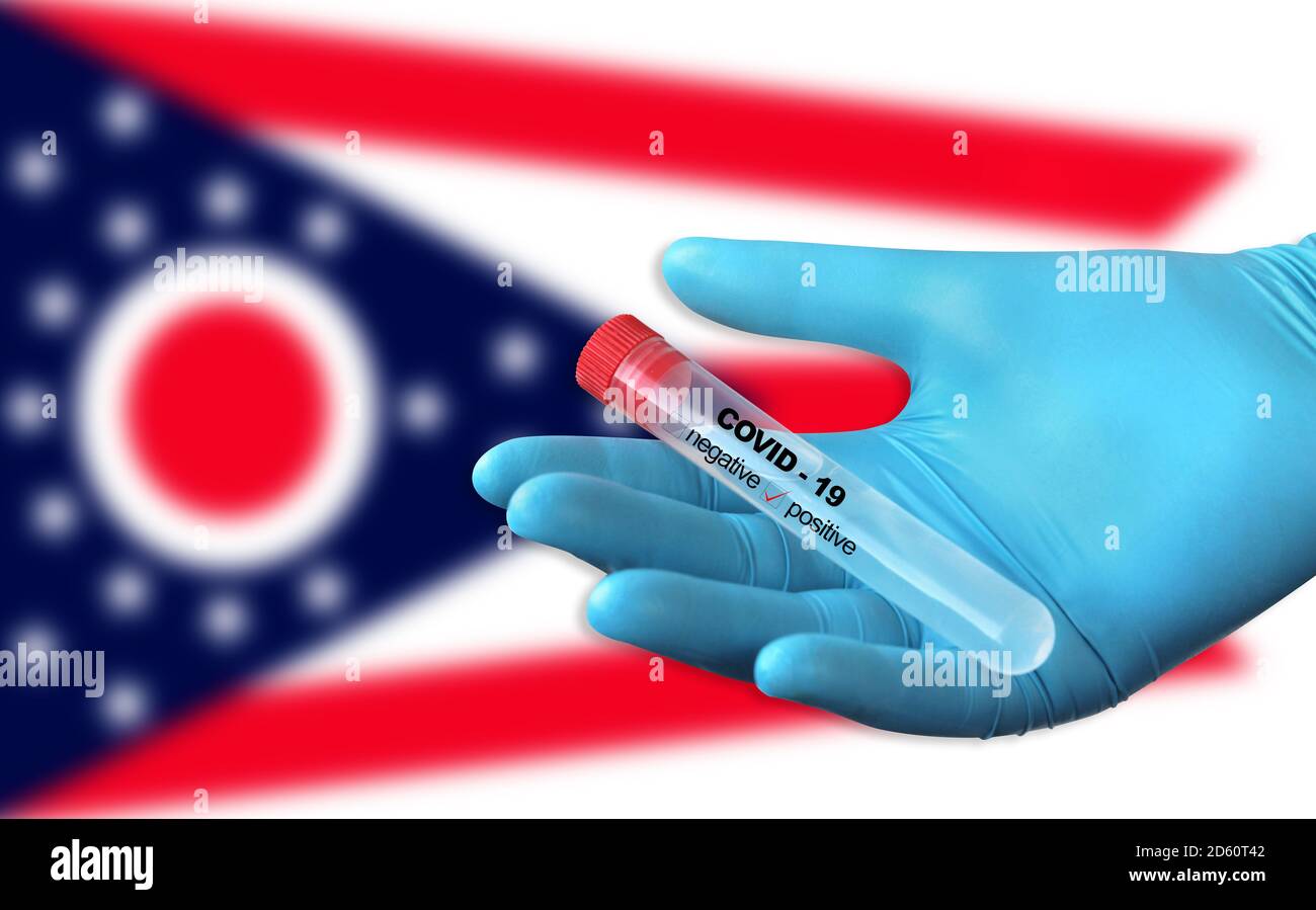 Testing for presence of coronavirus. Tube containing a swab sample that ...