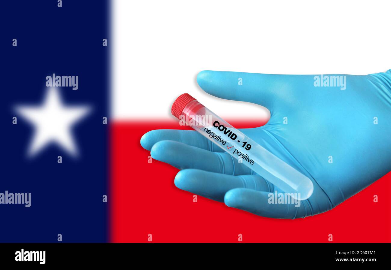 Testing for presence of coronavirus. Tube containing a swab sample that ...