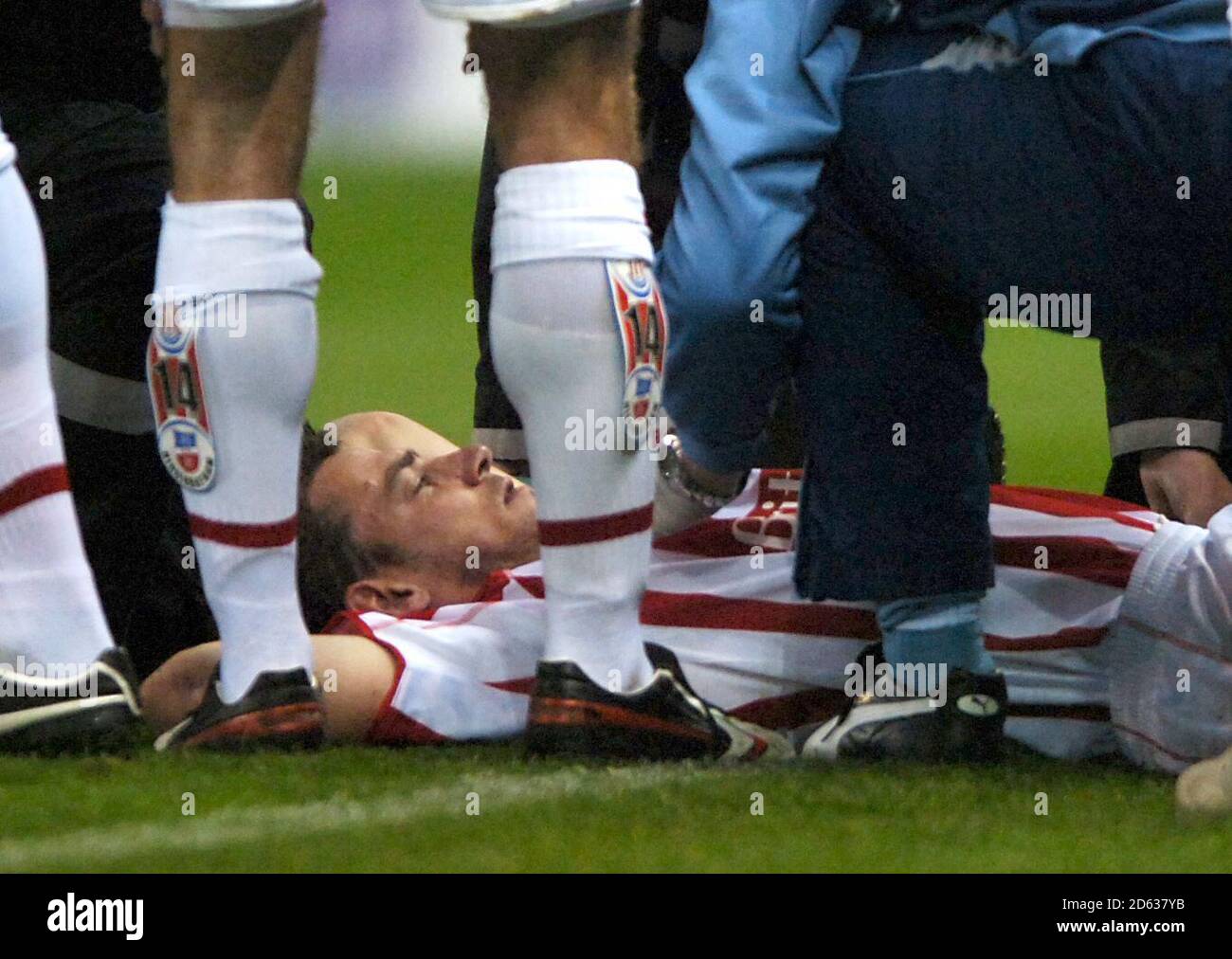 Football Injuries Broken Arm