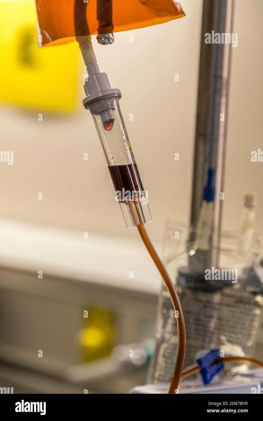 Intravenous infusion tubing hi-res stock photography and images - Alamy