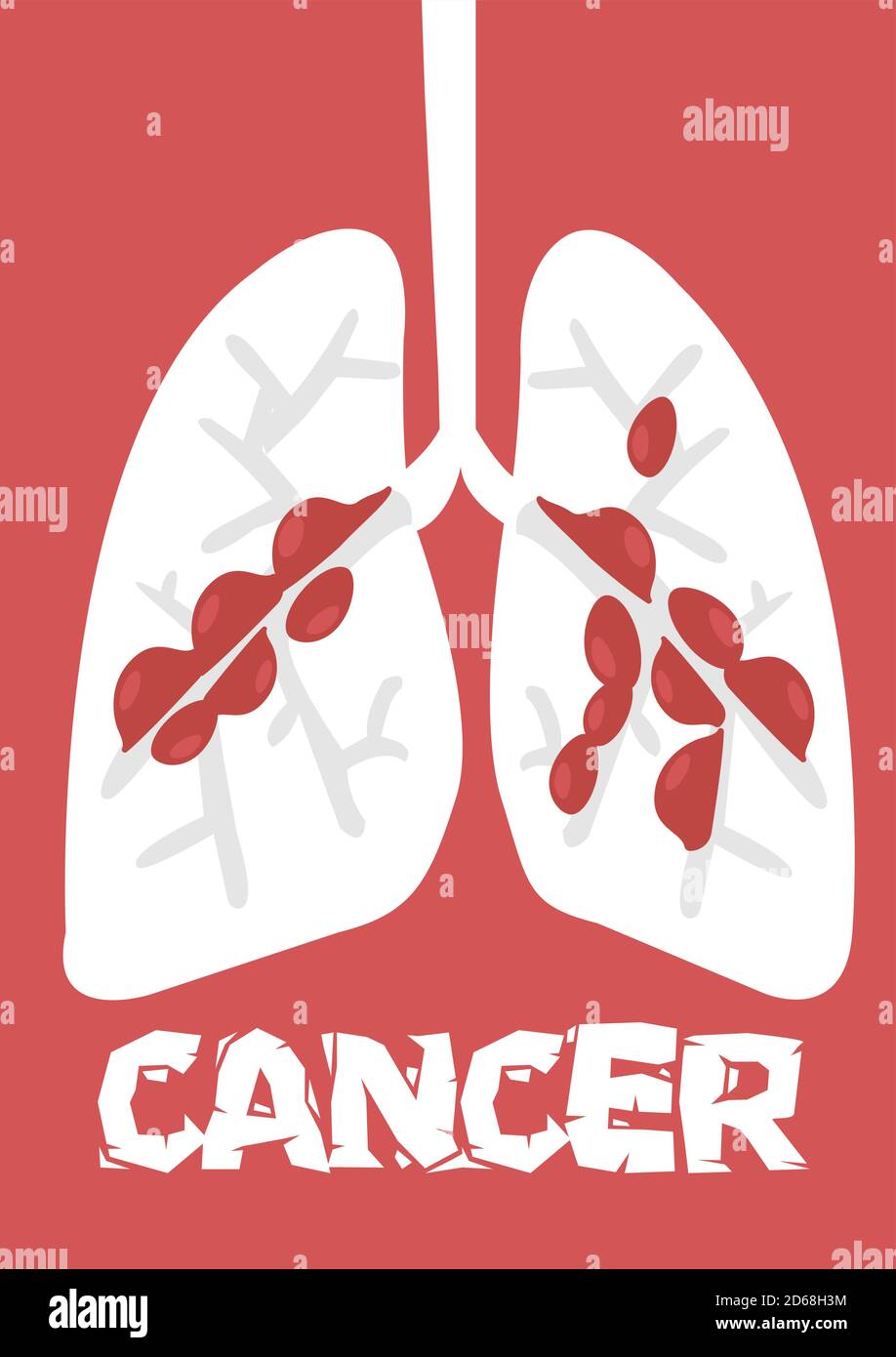 Flat cartoon lung cancer vector illustration on a red background Stock ...