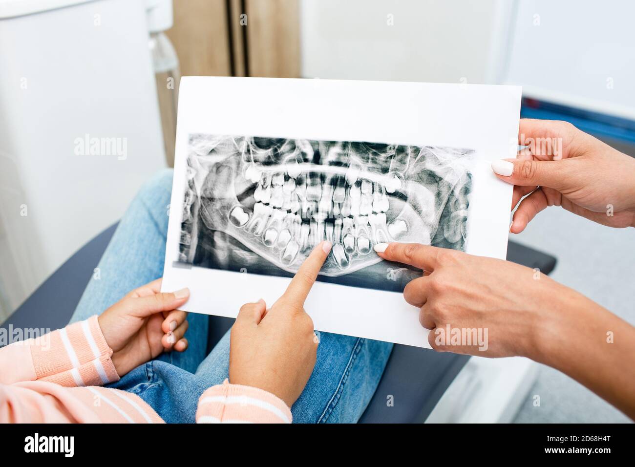 Healthy teeth x ray hi-res stock photography and images - Alamy