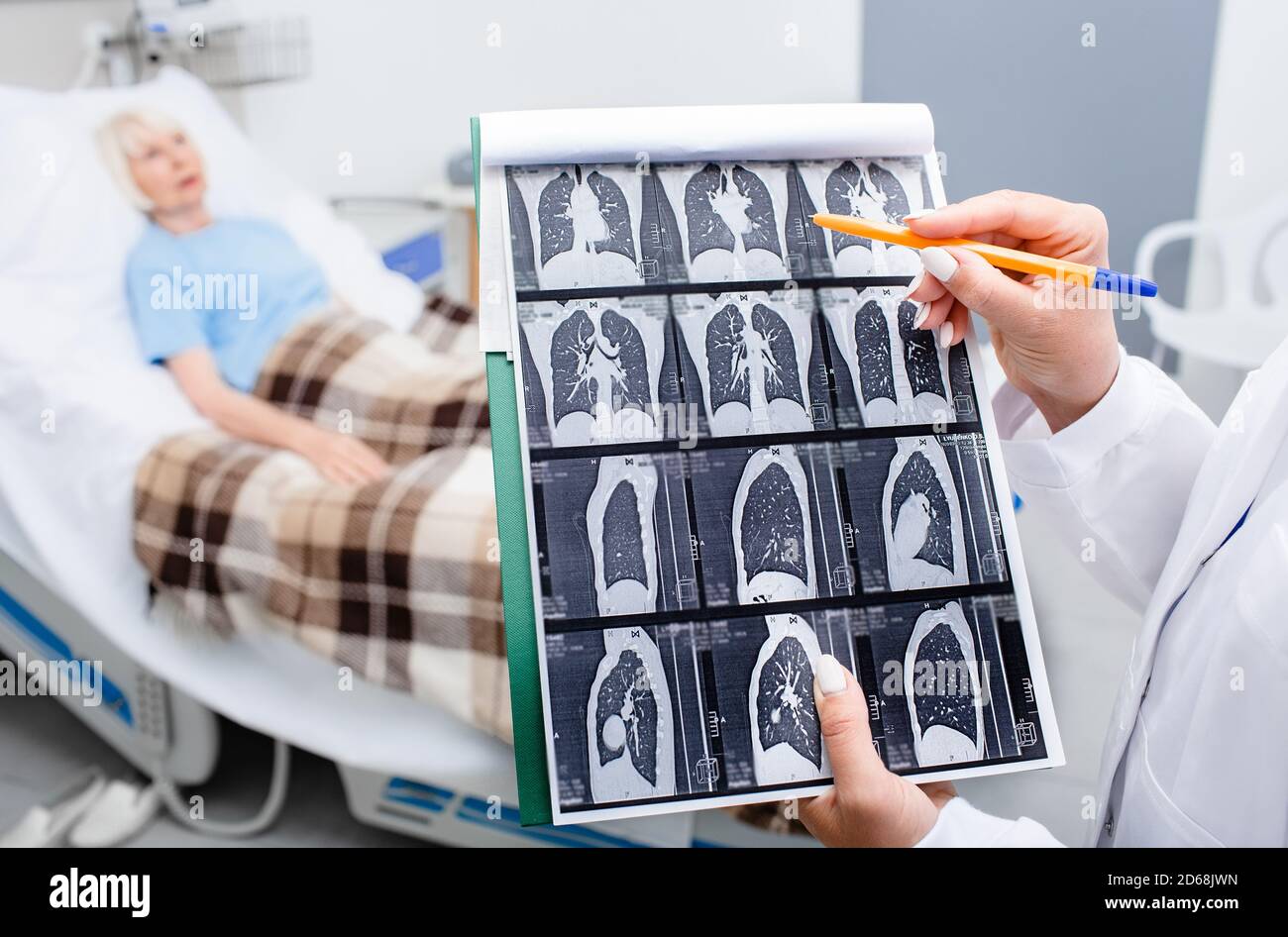 Close-up CT lung screening. Diagnostics and treatment of patients with ...