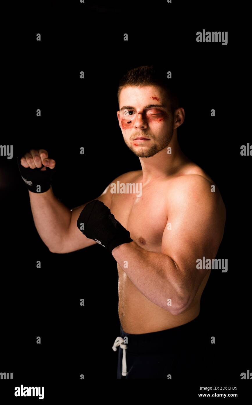 Boxer injured eye hi-res stock photography and images - Alamy