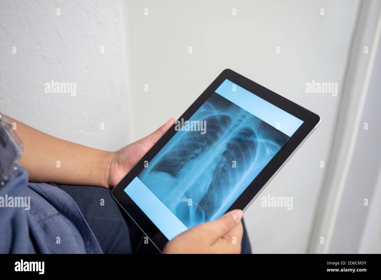 Hands holding digital tablet showing X-ray Stock Photo - Alamy