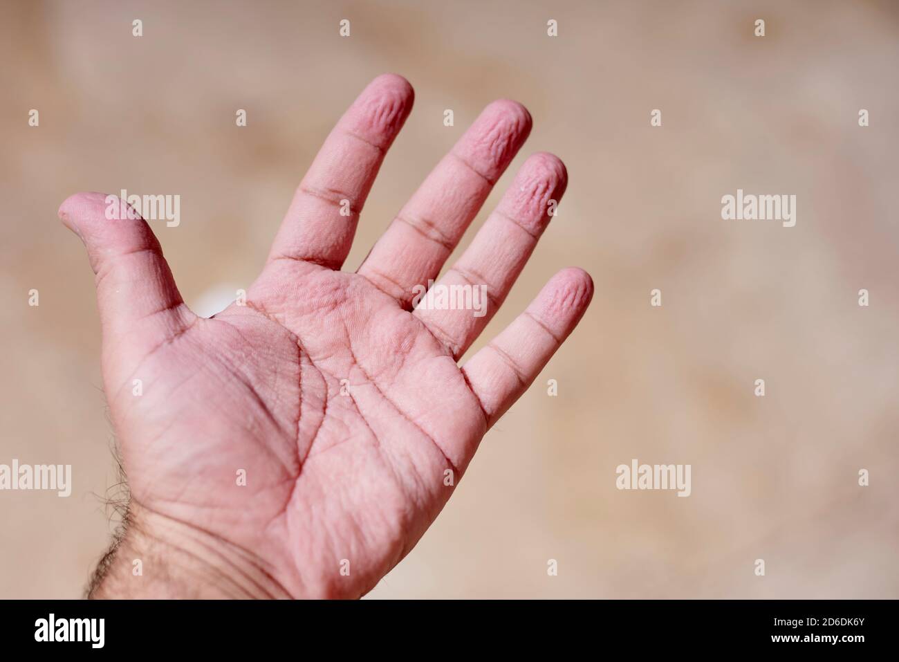 A man shocked with wrinkly and pruney skin of his hands after the bath ...