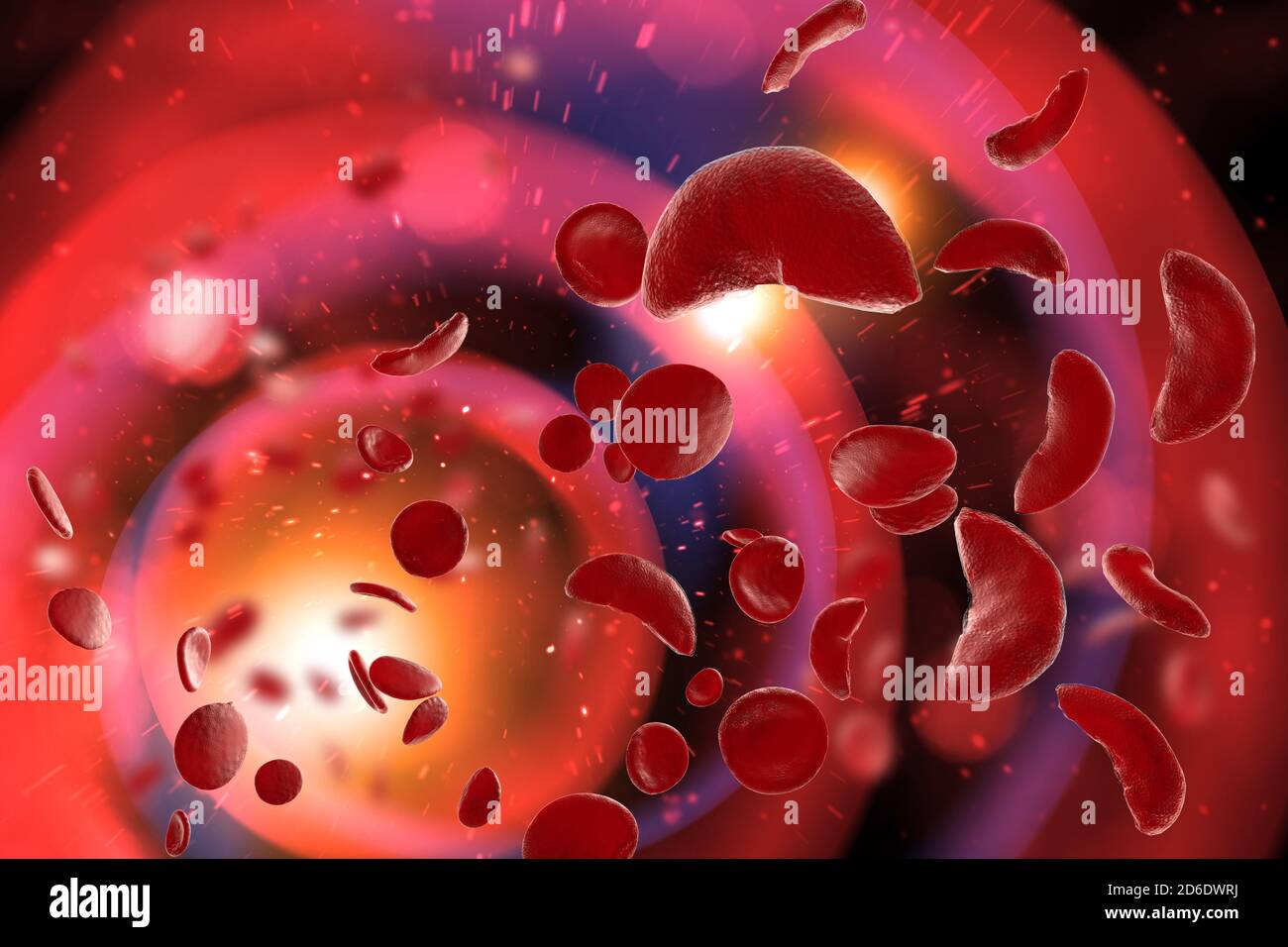 Sickle cell anemia disease (SCD) blood cells 3D illustration Stock ...