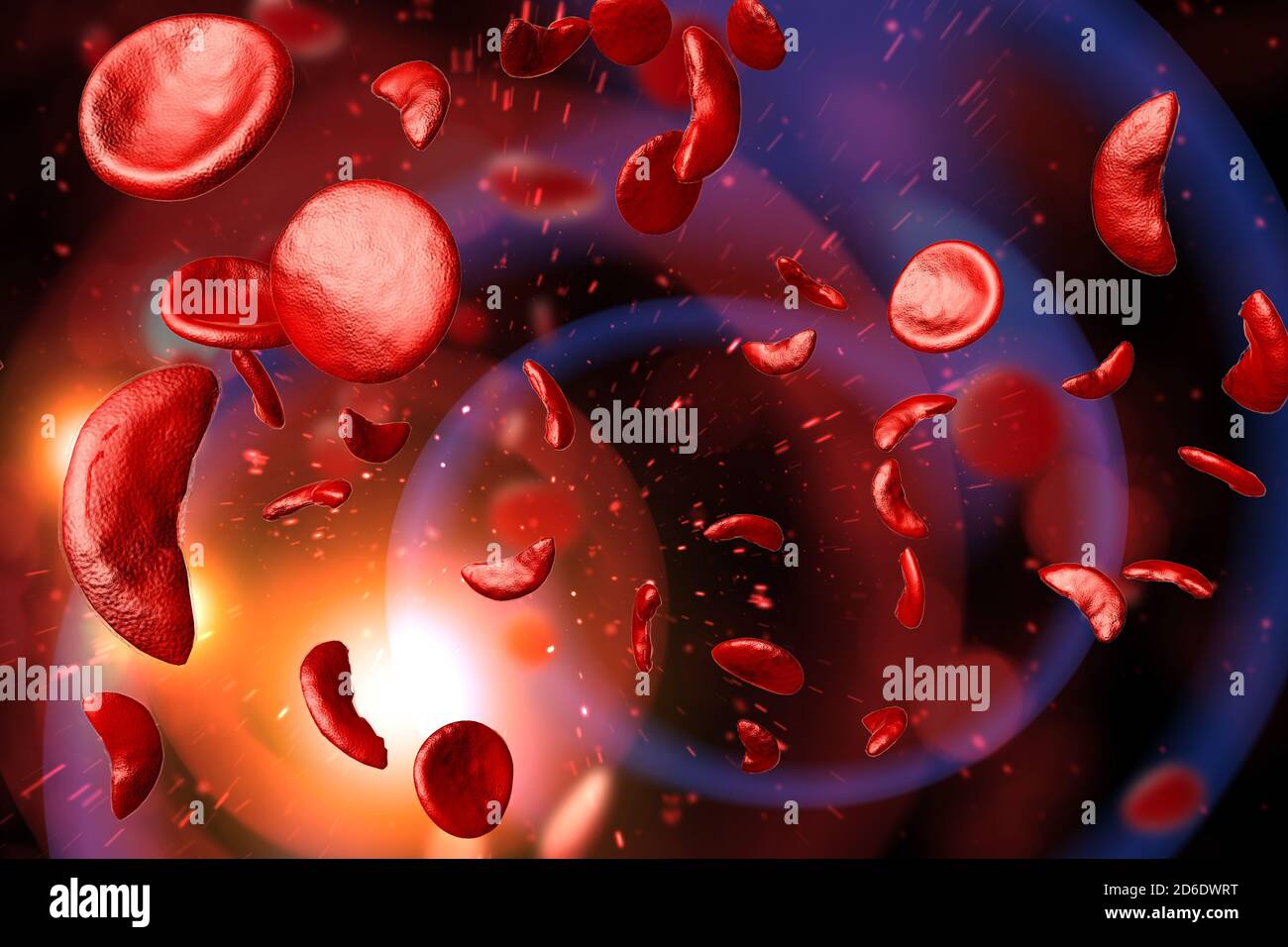 Sickle cell anemia blood cells hi-res stock photography and images - Alamy