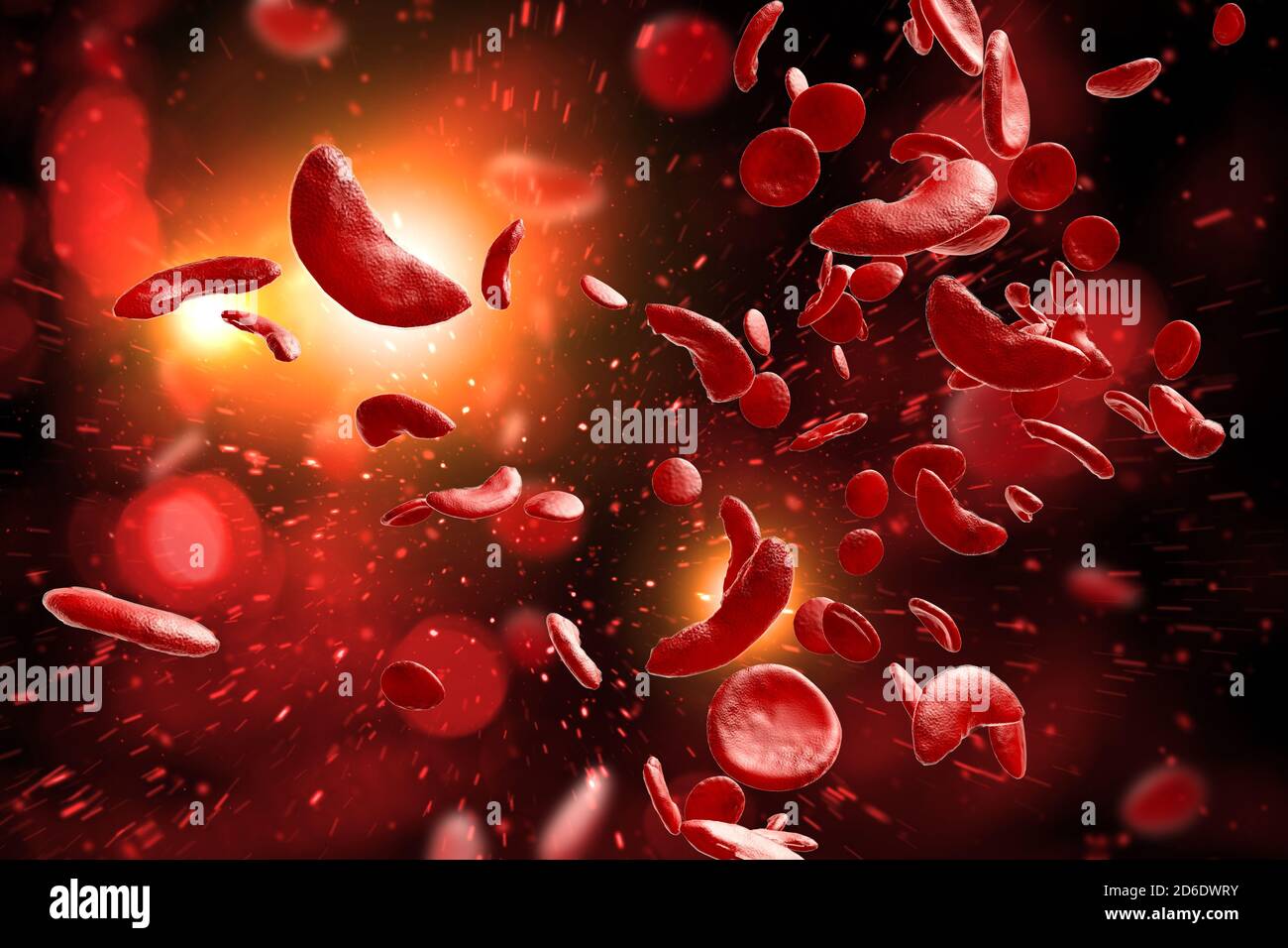 Sickle cell anemia disease (SCD) blood cells 3D illustration Stock ...