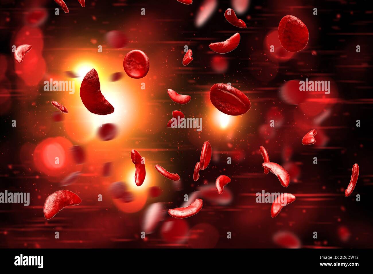Sickle cell anemia disease (SCD) blood cells 3D illustration Stock ...