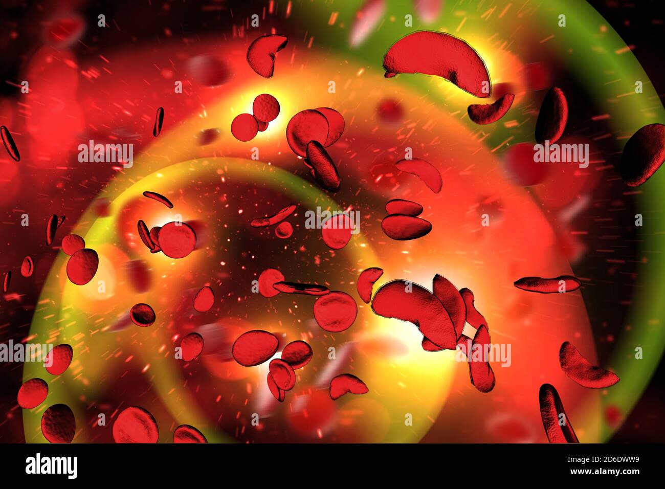 Sickle cell anemia disease (SCD) blood cells 3D illustration Stock ...