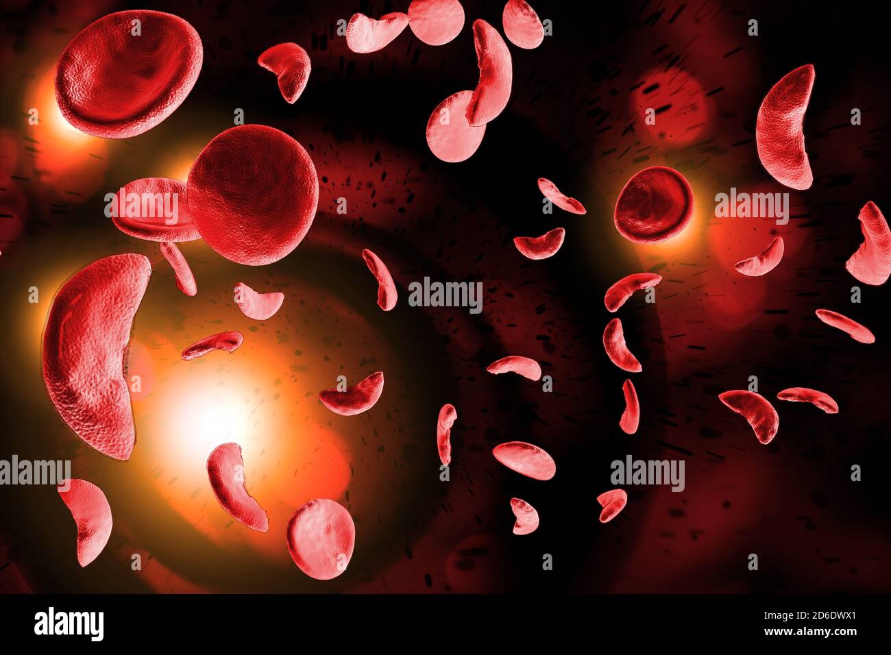 Sickle cell anemia disease (SCD) blood cells 3D illustration Stock ...