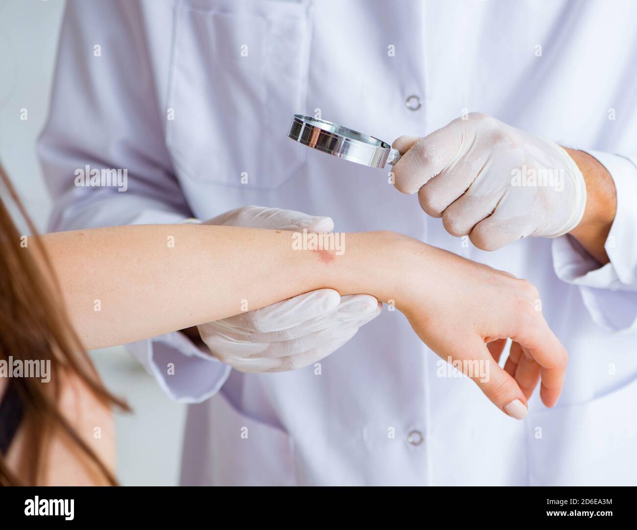 The doctor examining the skin of female patient Stock Photo - Alamy