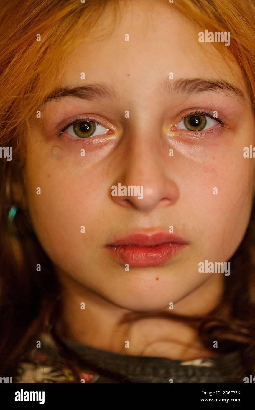Tears rolling kid hi-res stock photography and images - Alamy
