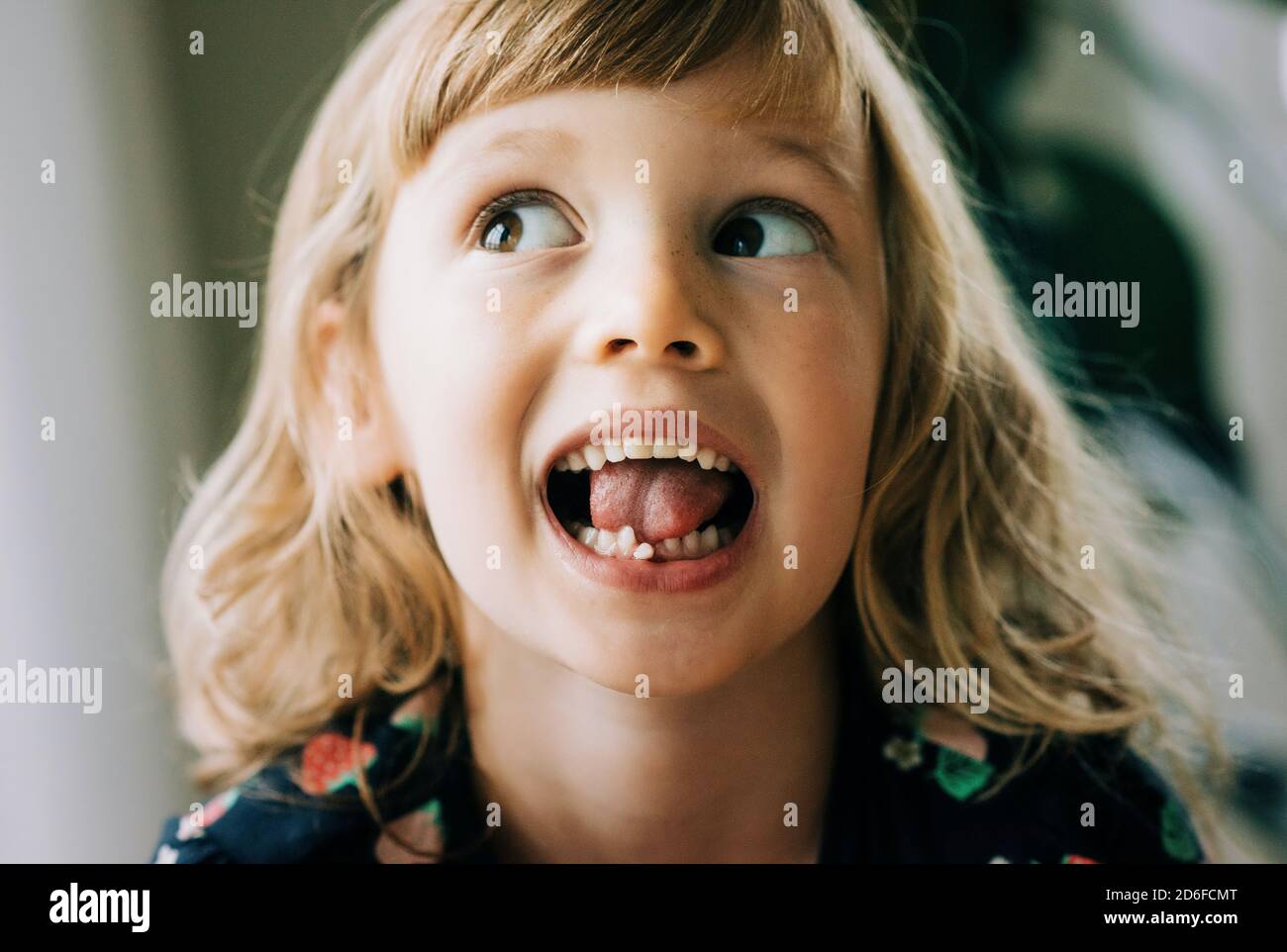 young girl with wobbly tooth pulling faces showing her tooth Stock ...